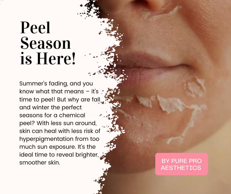 Peel season is here! Lets get ready to GLOW! – Pure Pro Aesthetics