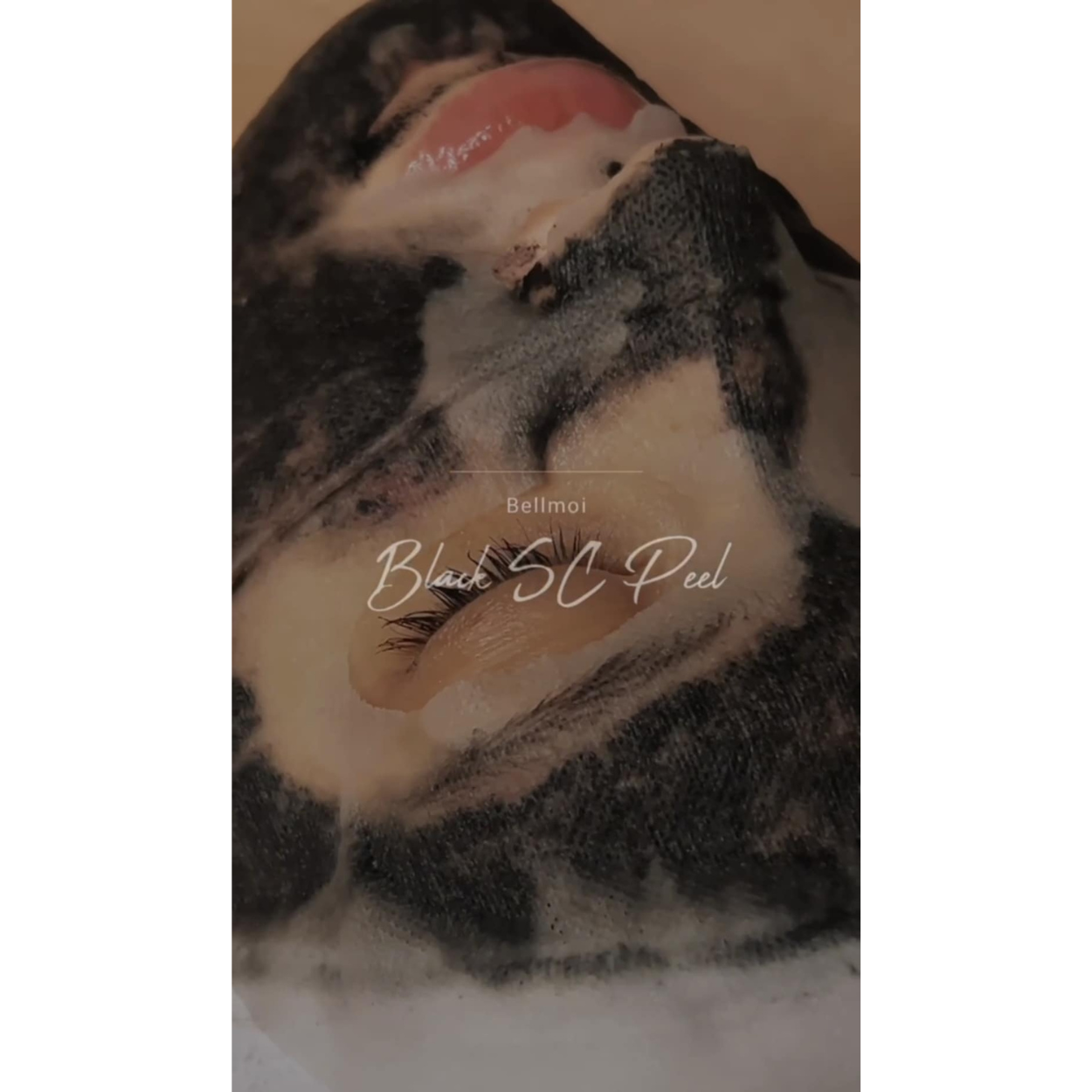 Understanding the Science Behind BellMoi Black Stem Cell Spicule Peel ...